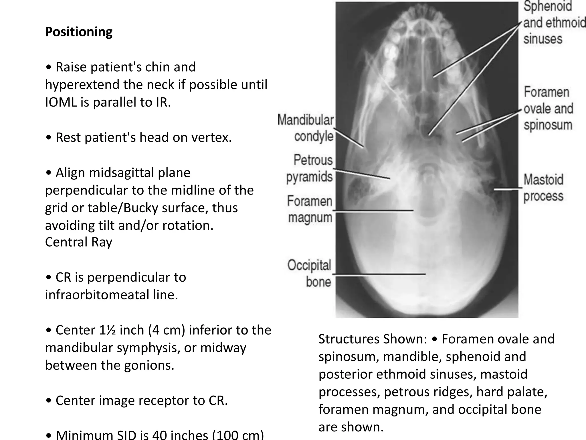 Plain X-ray SKULL | PPTX