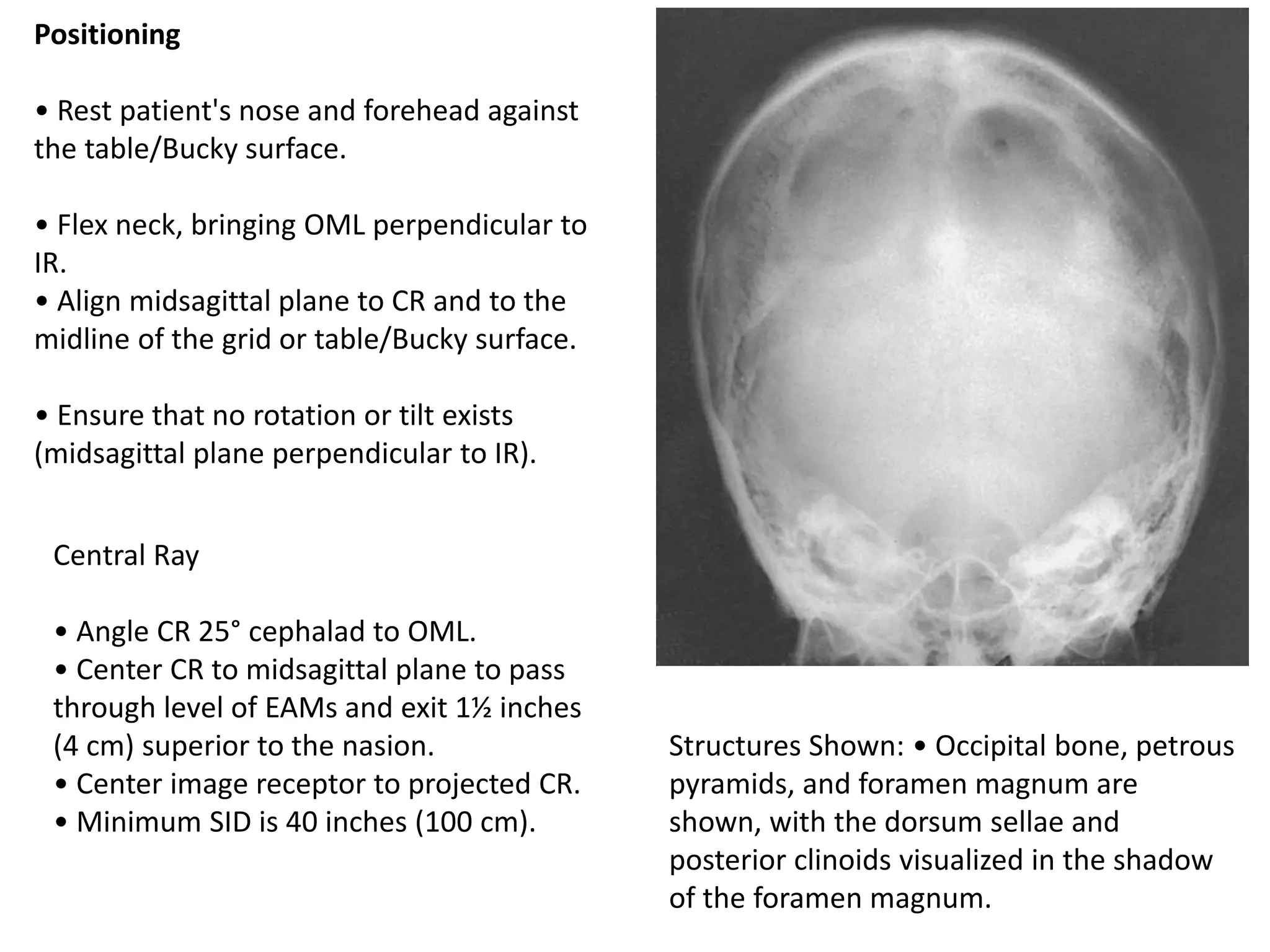 Plain X-ray SKULL | PPTX