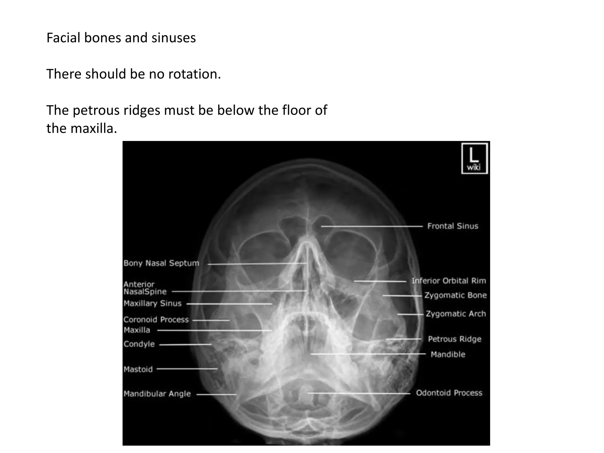 Plain X Ray Skull Pptx