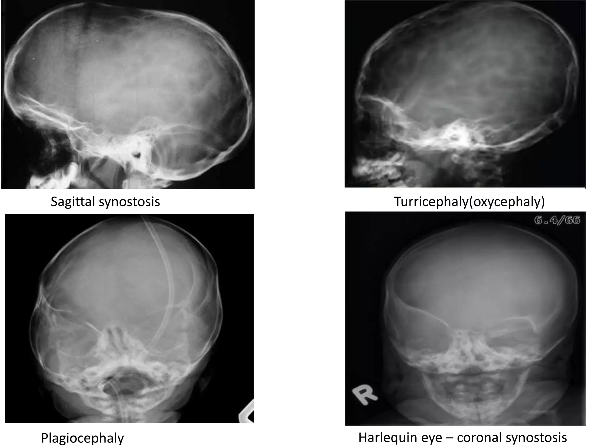 Plain X-ray SKULL | PPTX | Medical Tests | Medical Health