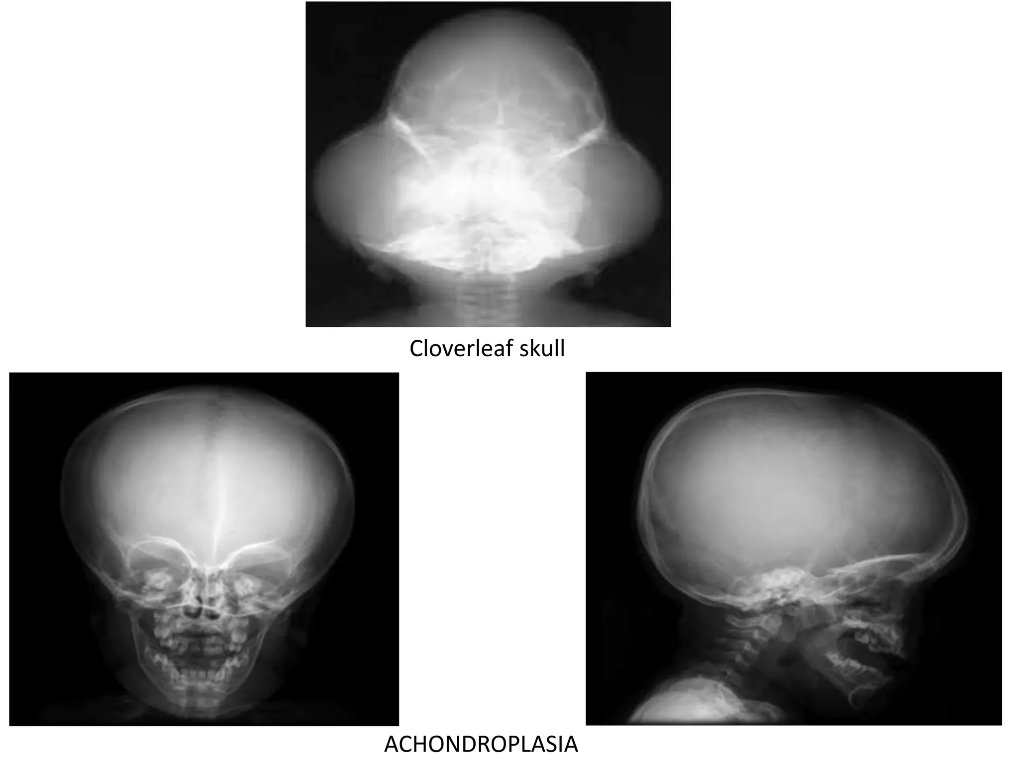 Plain X-ray SKULL | PPTX | Medical Tests | Medical Health