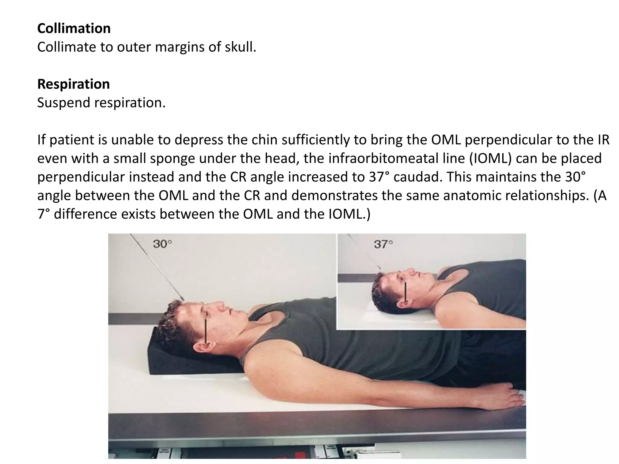 Plain X-ray SKULL | PPTX