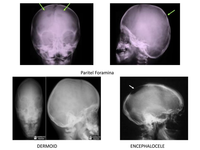 Plain X-ray SKULL | PPTX | Medical Tests | Medical Health