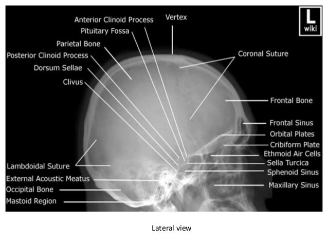 Plain X-ray SKULL