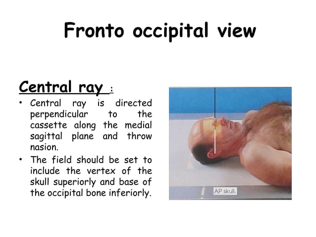 Intersting cases and spotters in skull xray | PPT