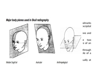 Intersting cases and spotters in skull xray | PPTX