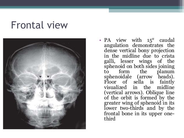 Skull x ray plain evaluations