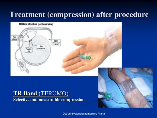 Skvaril J - AIMRADIAL 2013 - Avoid radial occlusion