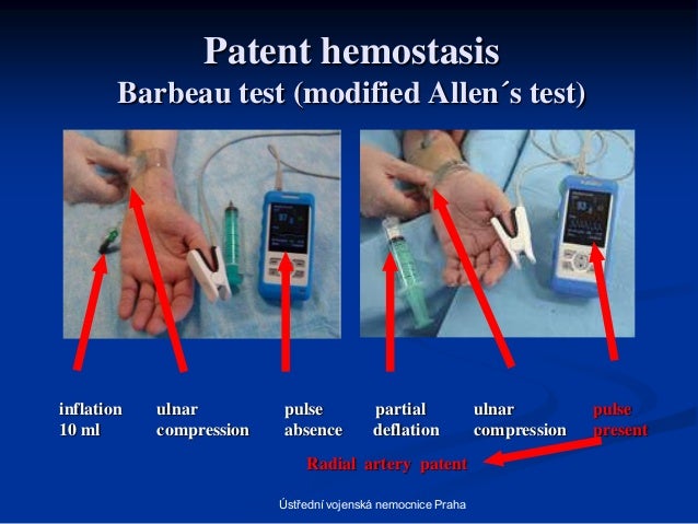 Skvaril J - AIMRADIAL 2013 - Avoid radial occlusion