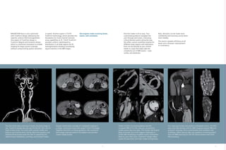 SIEMENS - Skyra - 3T | PDF