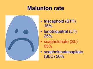 SL and SLC arthrodesis - heretic solutions?, power point | PPT