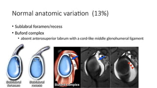 shoulder superior labrum anterior to posterior (SLAP) lesion.pptx