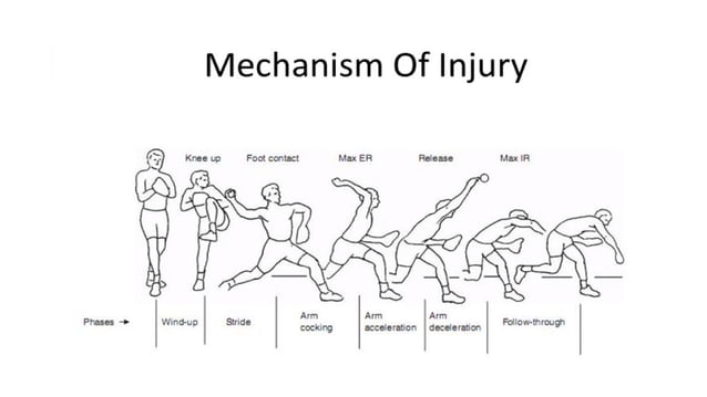 SLAP LESION CONSERVATIVE AND SPORTS REHABILITATION | PPTX | Death ...