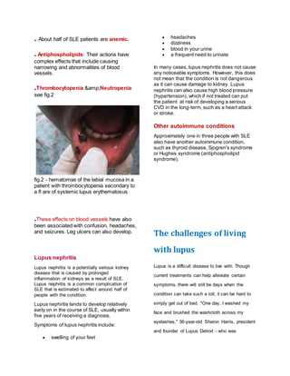Systemic Lupus Erythematosus | DOCX