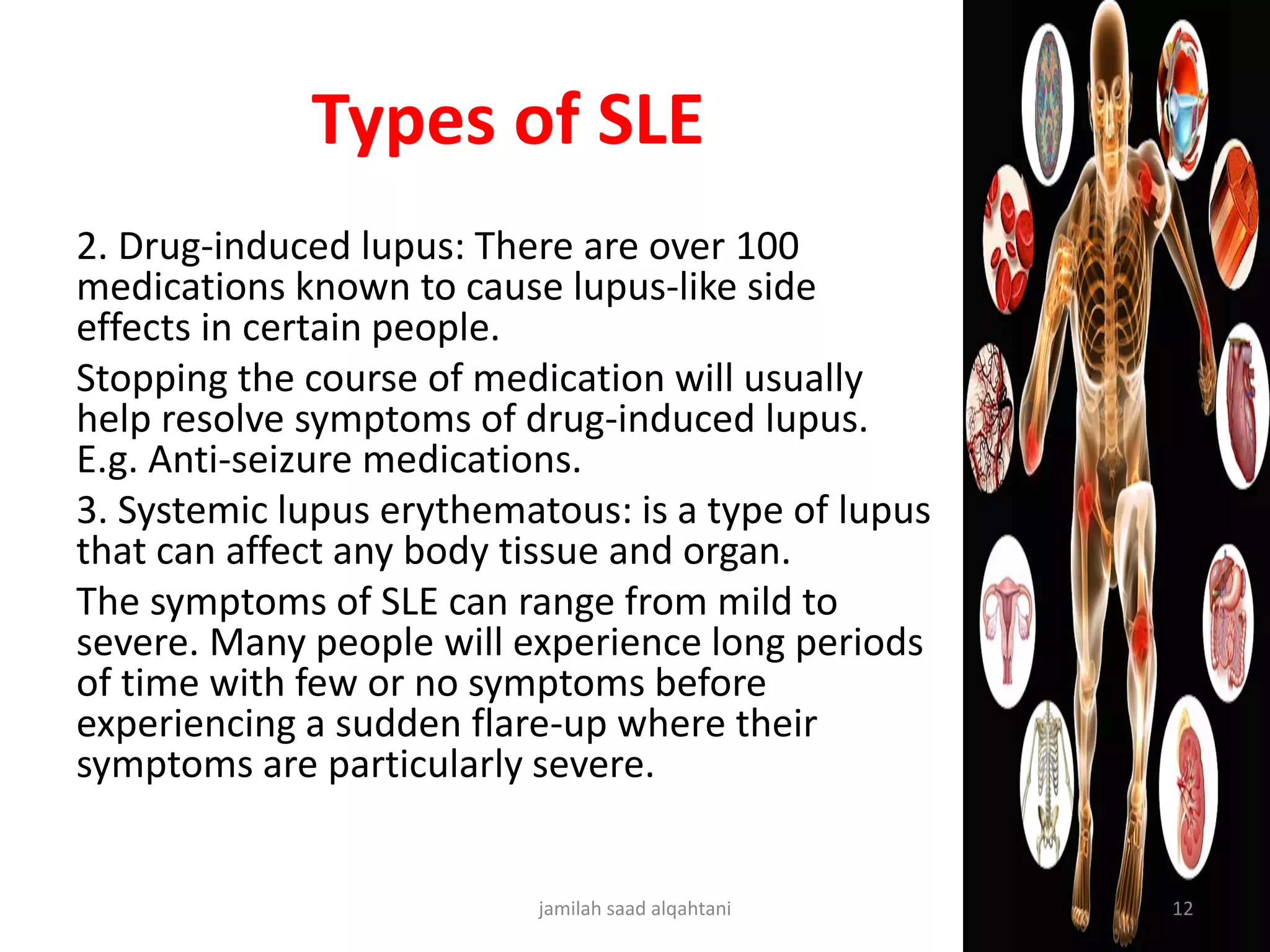 Systemic Lupus Erythematous (SLE) | PPTX