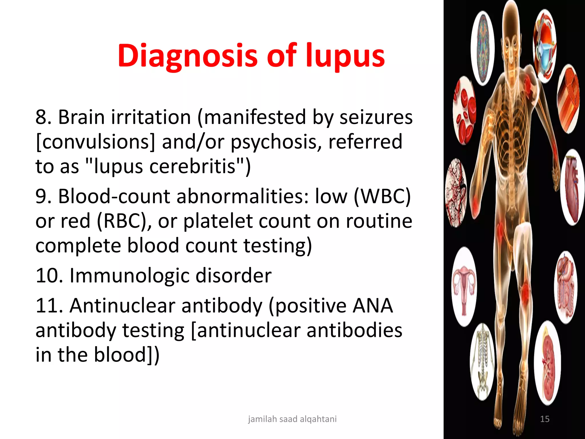 Systemic Lupus Erythematous (SLE) | PPTX
