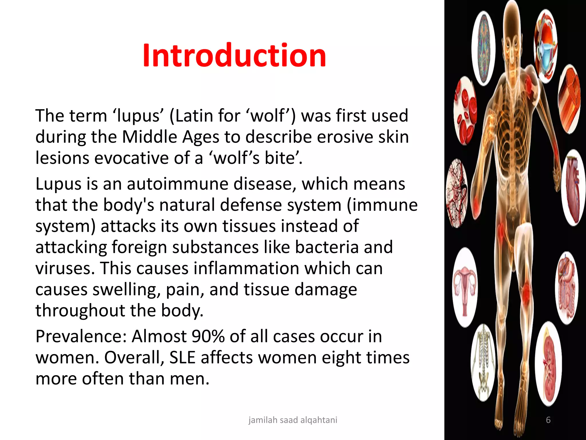 Systemic Lupus Erythematous (SLE) | PPTX