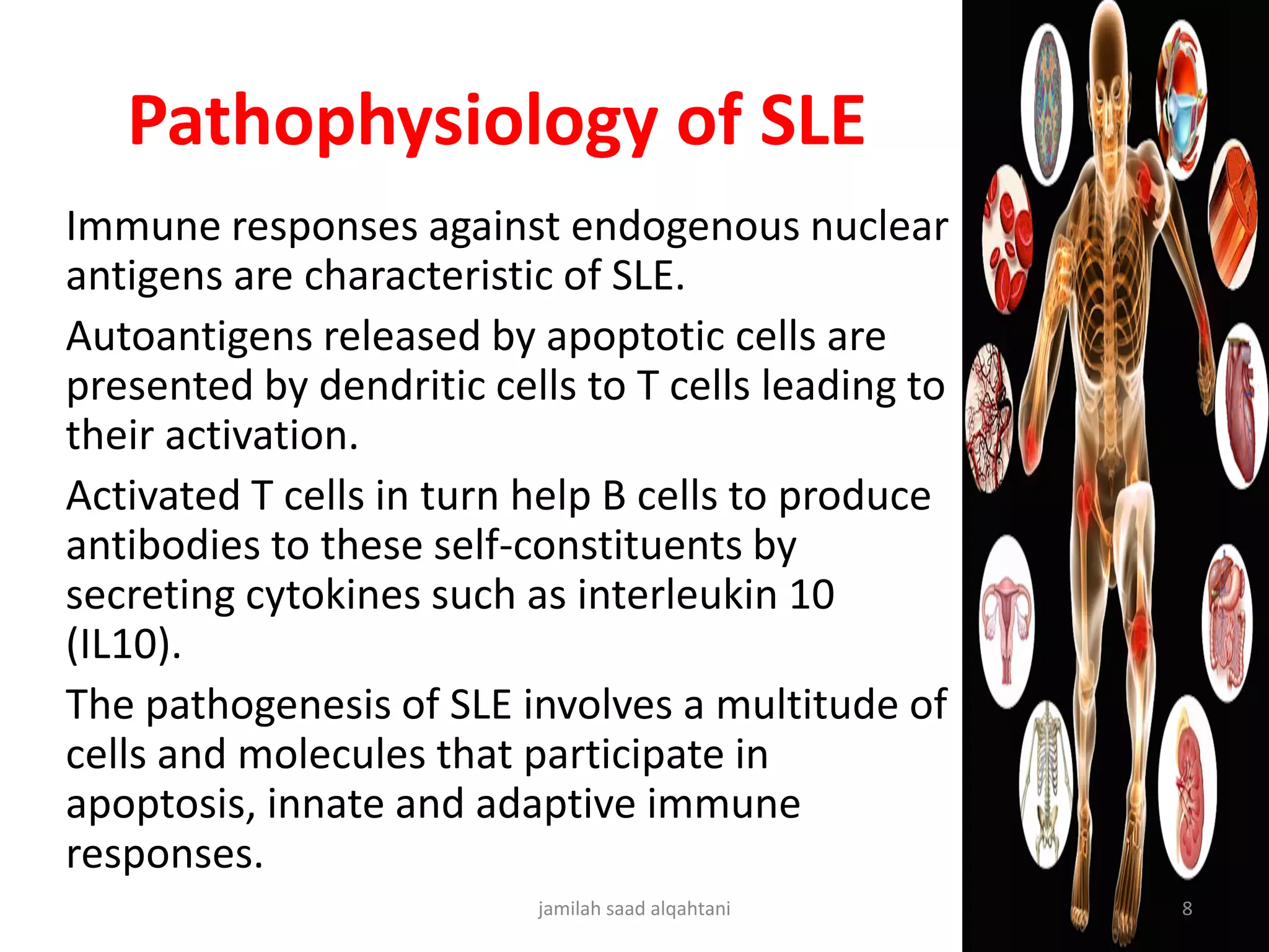 Systemic Lupus Erythematous (SLE) | PPTX