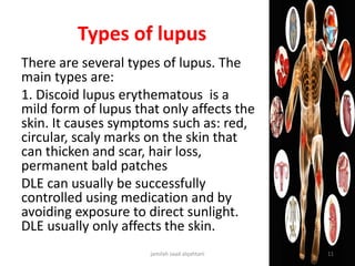 Systemic Lupus Erythematous (SLE) | PPTX