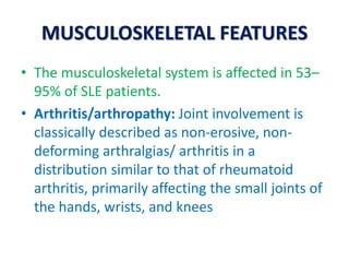 SYSTEMIC LUPUS ERYTHEMATOSUS (SLE | PPTX