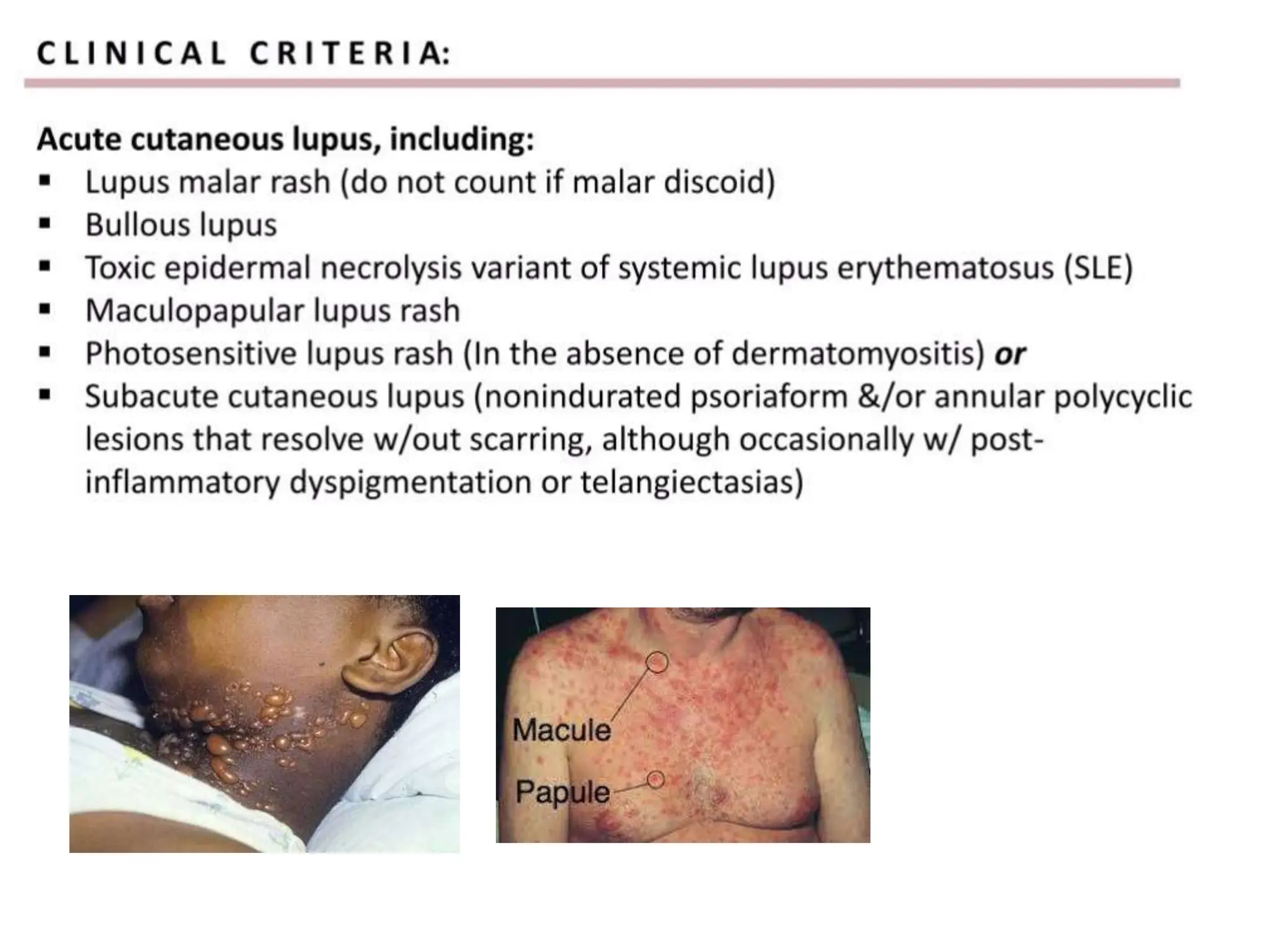 Clinical Pharmacotherapy of Systemic Lupus Erythematous | PPTX ...