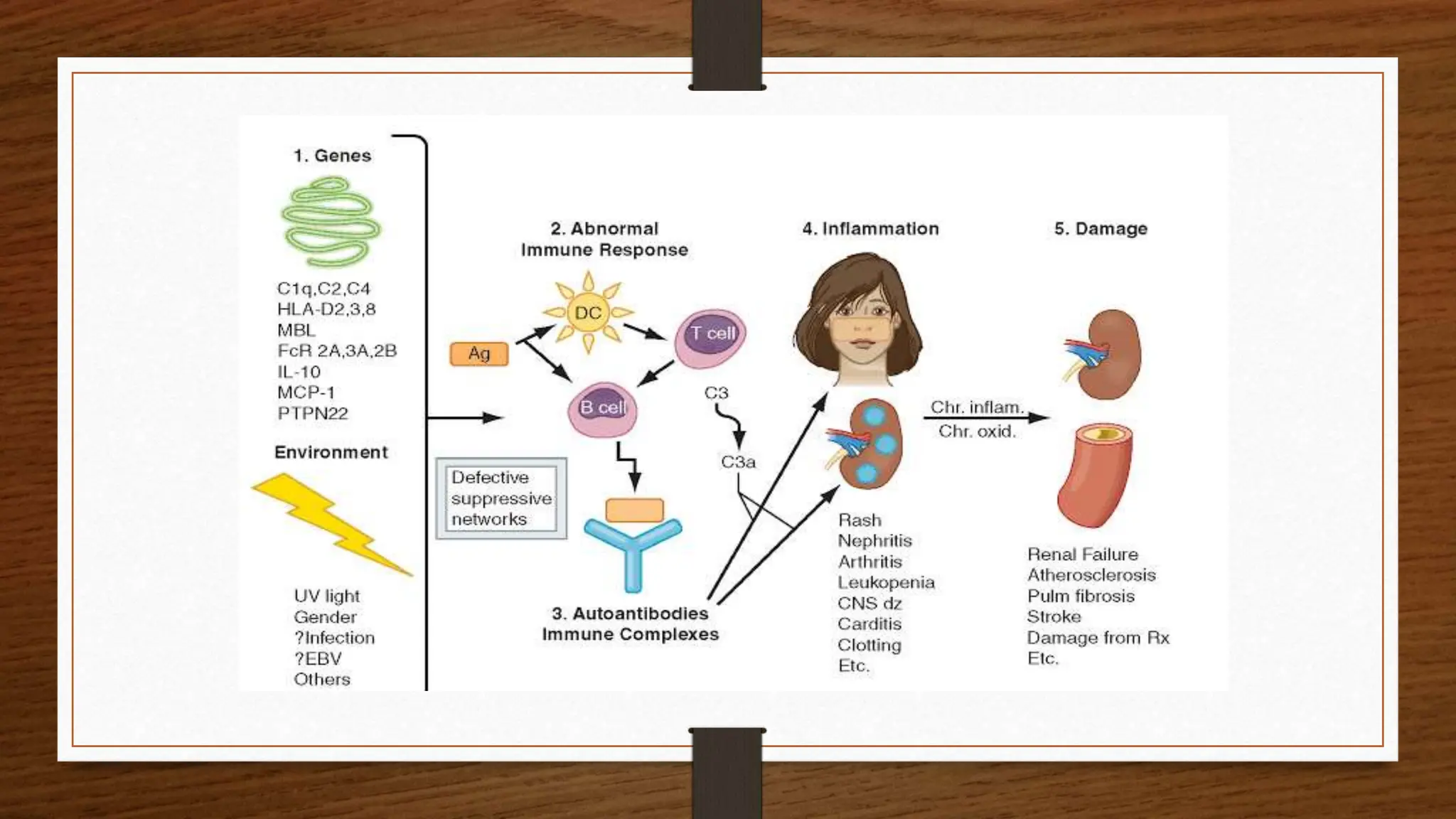 Systemic lupus erythematosus, an autoimmune disorder | PPT