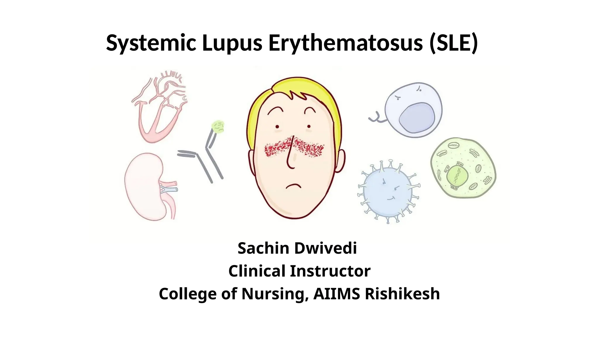 Systemic lupus erythematosus and its management | PPTX
