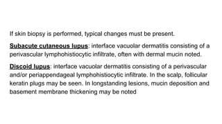 Systemic Lupus Erythematosus ( SLE ) - Classification Criteria .pdf