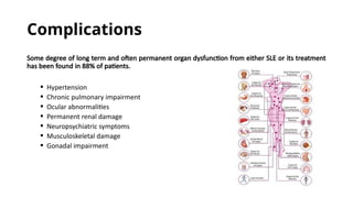 Systemic lupus erythematosus (SLE) & its Management | PPTX