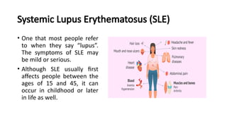 Systemic lupus erythematosus (SLE) & its Management | PPT