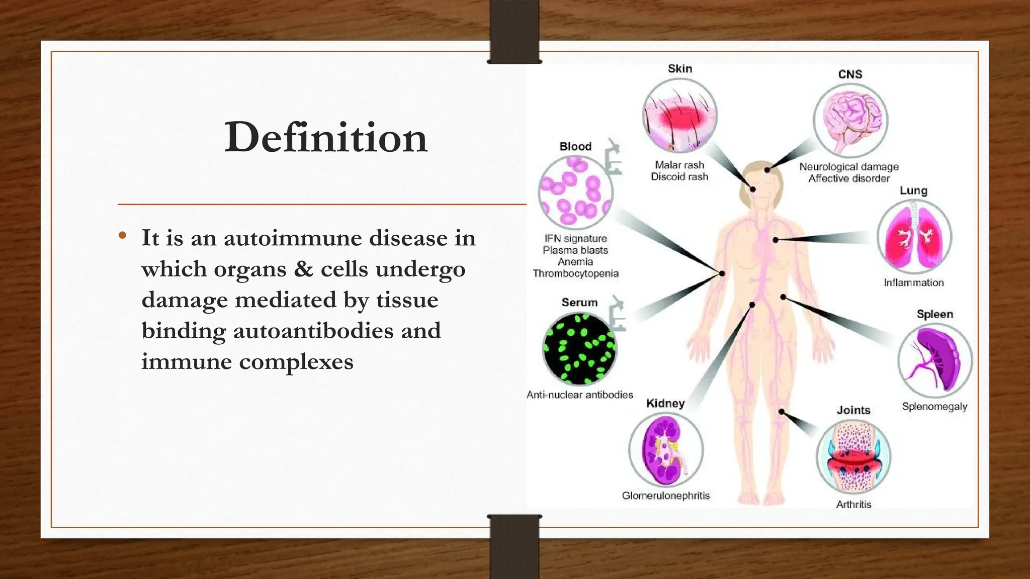 Systemic lupus erythematous SLE ppt.pptx