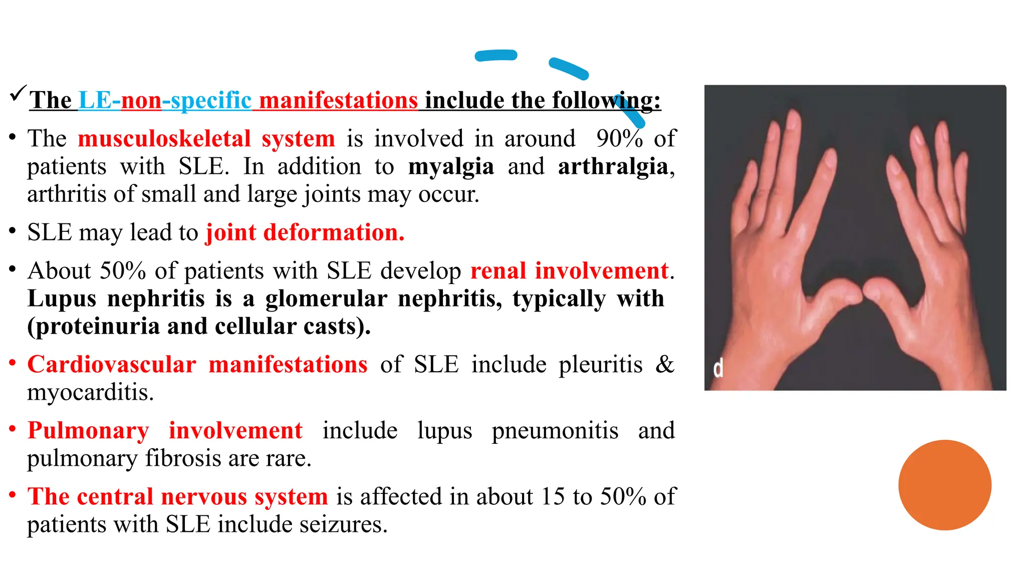 Systemic Lupus Erythematoses aaaaa..pptx