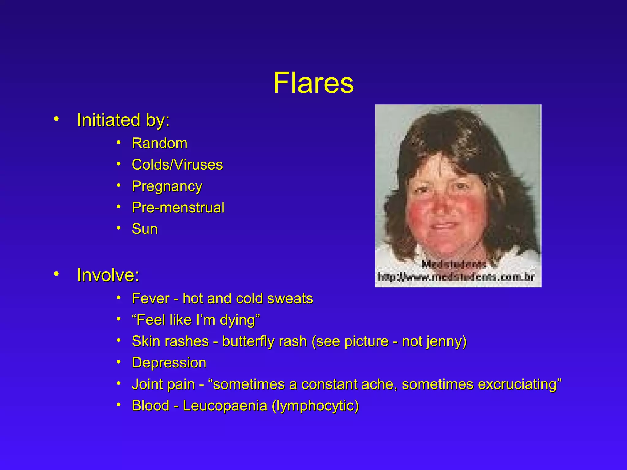 SLE: Case Presentation | PPT