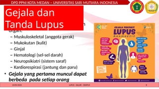 lupus dan kegunaannya SLE - SALURI - ODAPUS.pptx