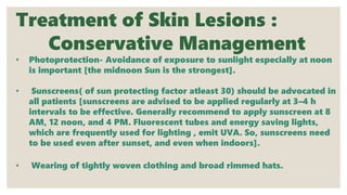 SLE- SYSTEMIC LUPUS ERYTHEMATOUS...pptx. | PPTX