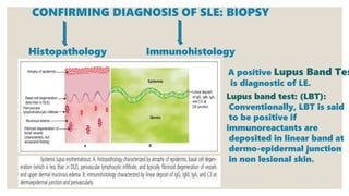 SLE- SYSTEMIC LUPUS ERYTHEMATOUS...pptx. | PPTX