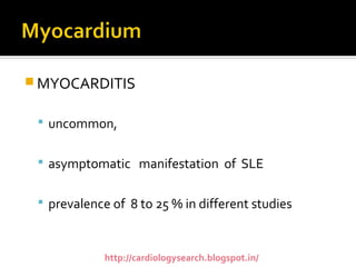 SLE and cardiovascular manifestations | PPT
