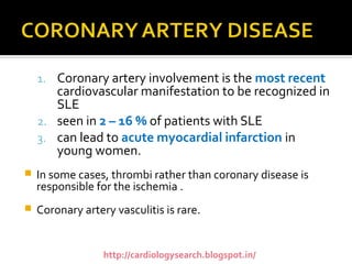 SLE and cardiovascular manifestations | PPT