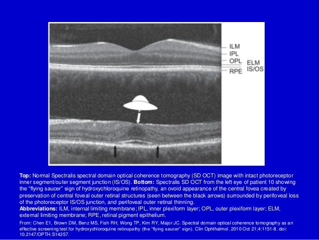 Sle an update_lfa_20151007
