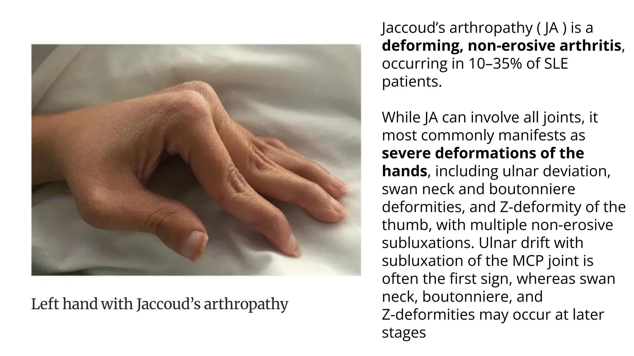 Clinical Manifestations of Systemic Lupus Erythematosus.pdf