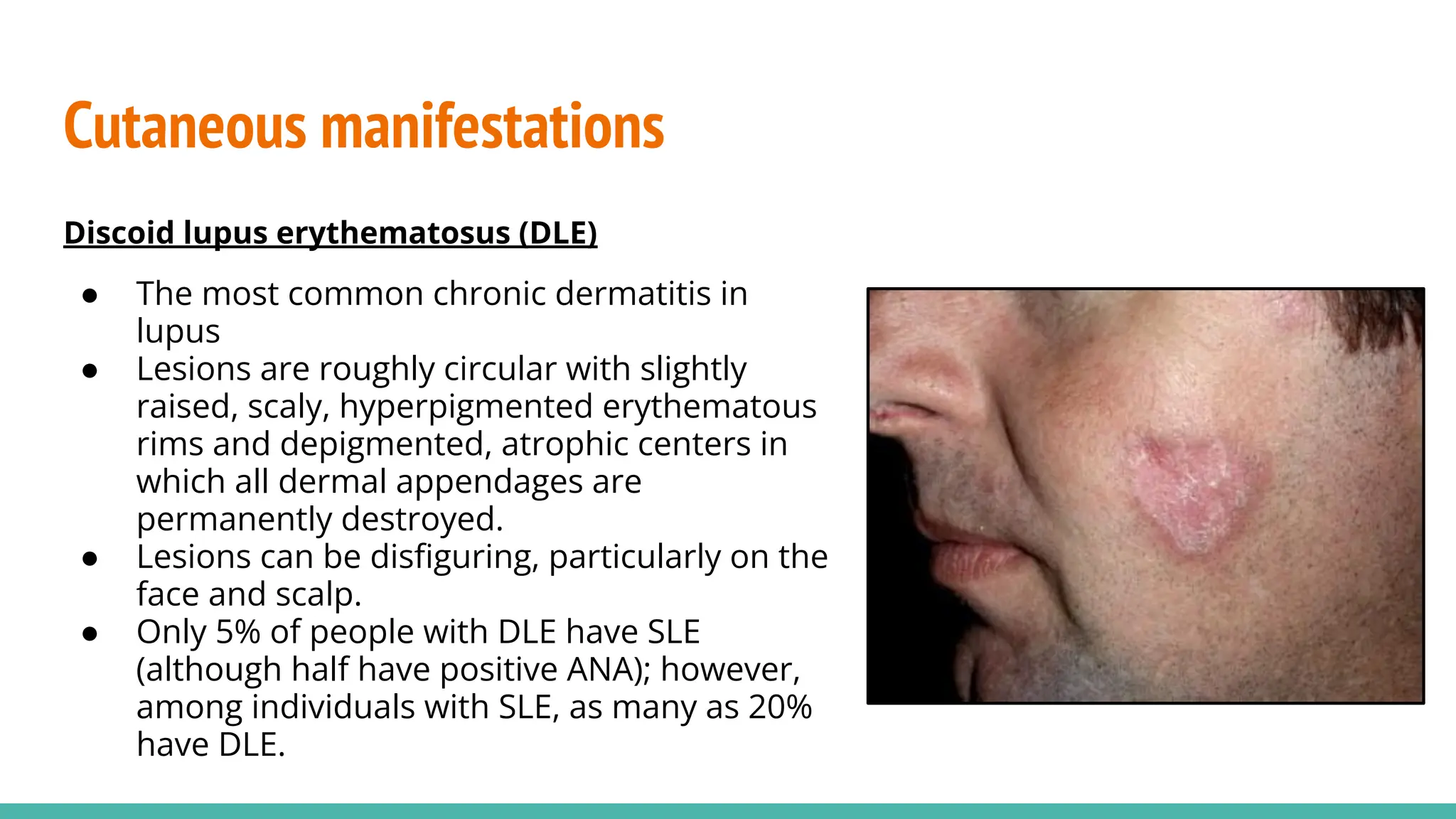Clinical Manifestations of Systemic Lupus Erythematosus.pdf