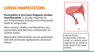 Clinical Manifestations of Systemic Lupus Erythematosus.pdf