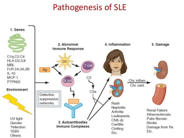 Sle diagnosis & treatment