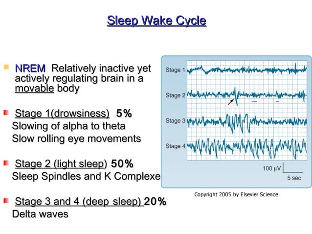 Sleep Study Interpretation | PPT