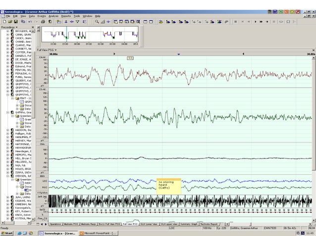 Sleep Study Interpretation | PPT