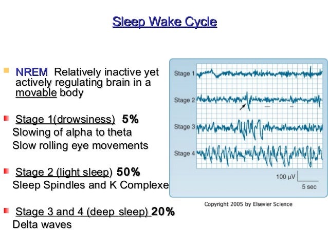 Sleep Study Interpretation