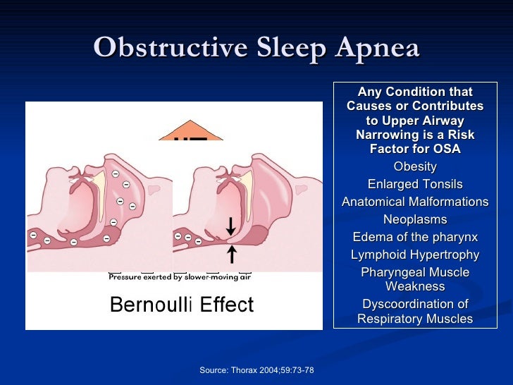 Sleep Apnea and the Eye - 2008