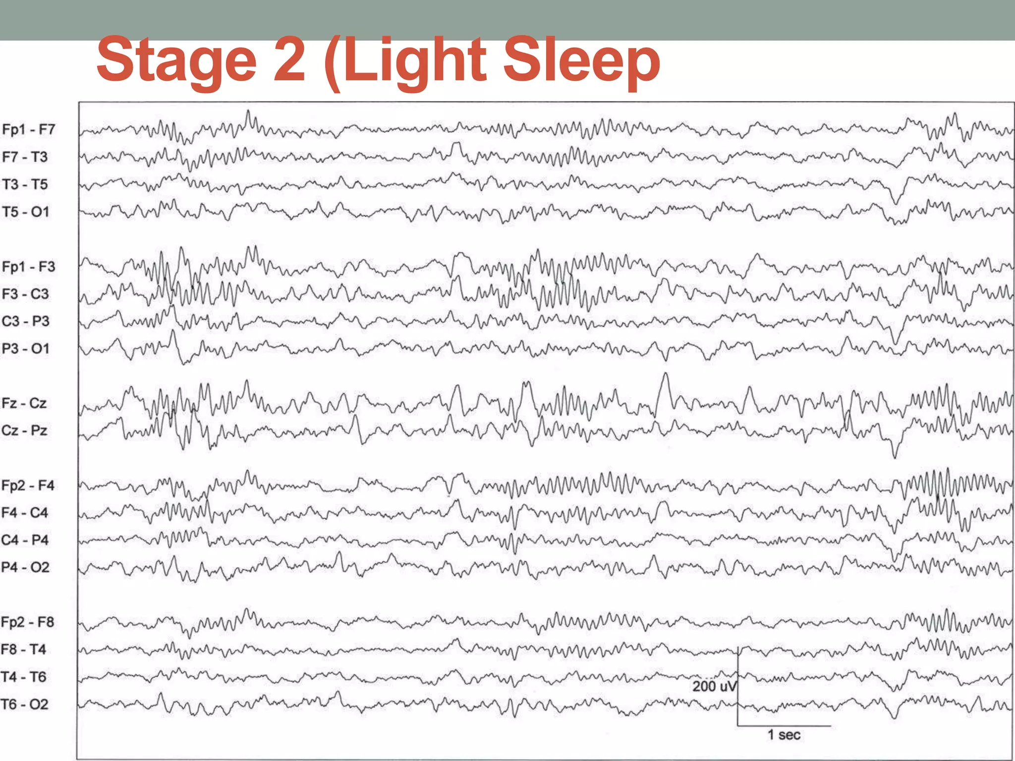 Sleep activity in eeg | PPTX