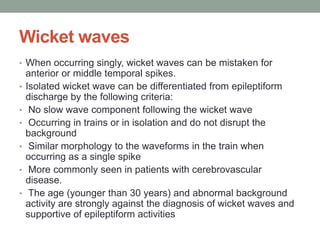 Sleep activity in eeg | PPT