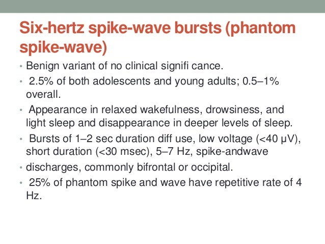 Sleep activity in eeg